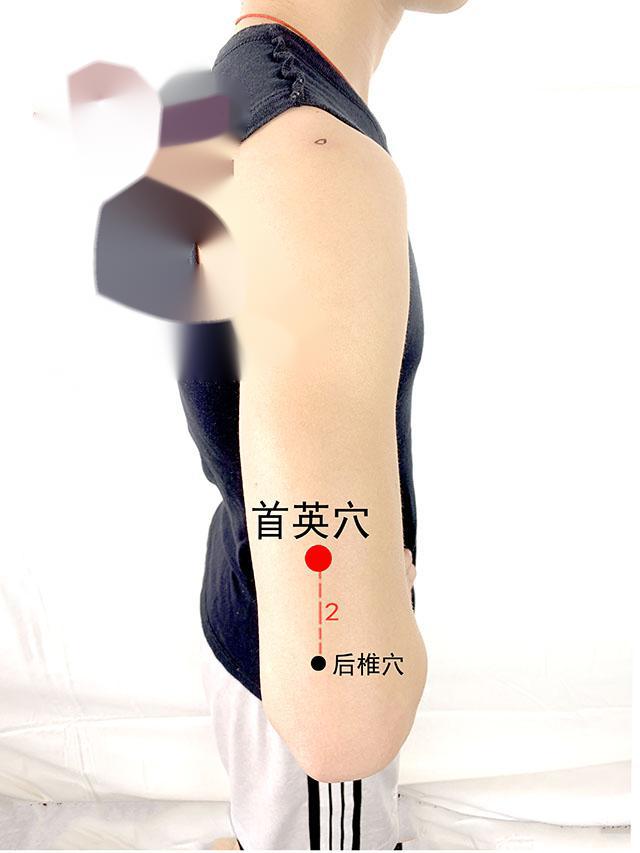 TCM acupuncture and upper extremity disease prescription 6 - iNEWS