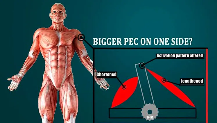 Is your whole body crooked?"Asymmetry and imbalance"-quietly making you ...