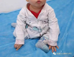 This common sitting posture affects baby's development? The correct ...