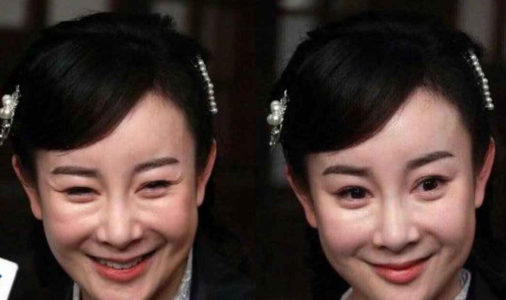 10 female celebrities ruined by plastic surgery, with snake-like faces ...