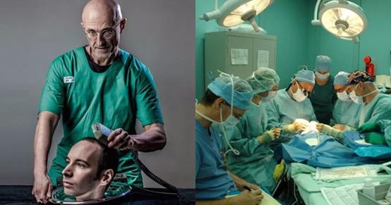 Can "head changing technique" achieve immortality?Got slapped in the ...