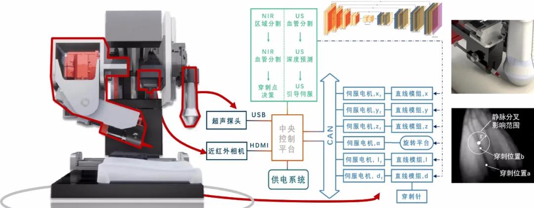 The Tongji University team developed an automatic needle-piercing robot ...