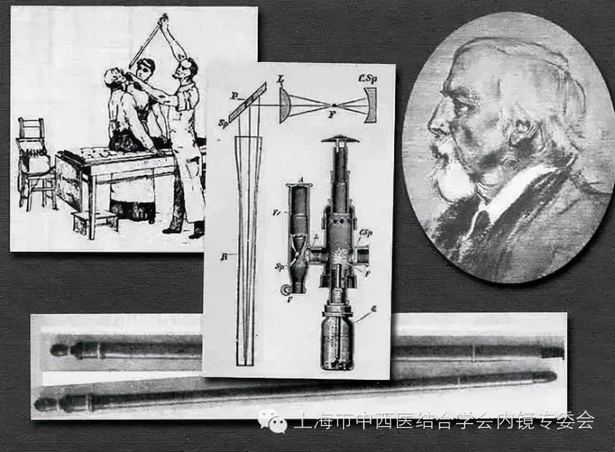 History of Ultrasound Endoscopy - iNEWS