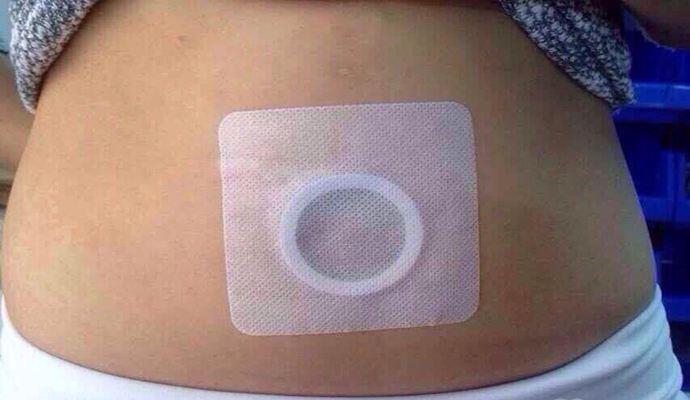 The belly button is connected to the intestine.1000 times magnification ...