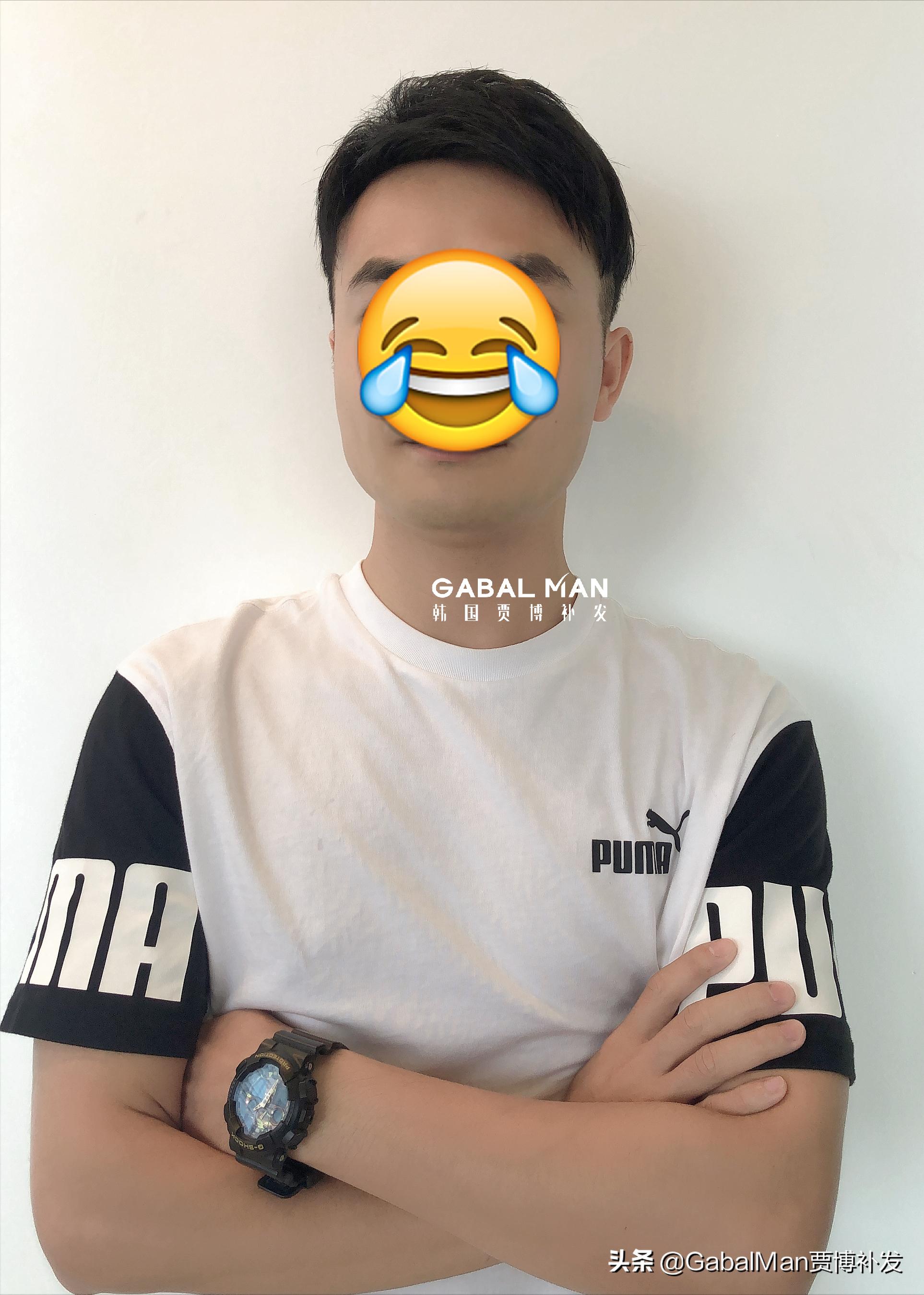 21-year-old is called "Uncle Bald", mastering this method will make you ...