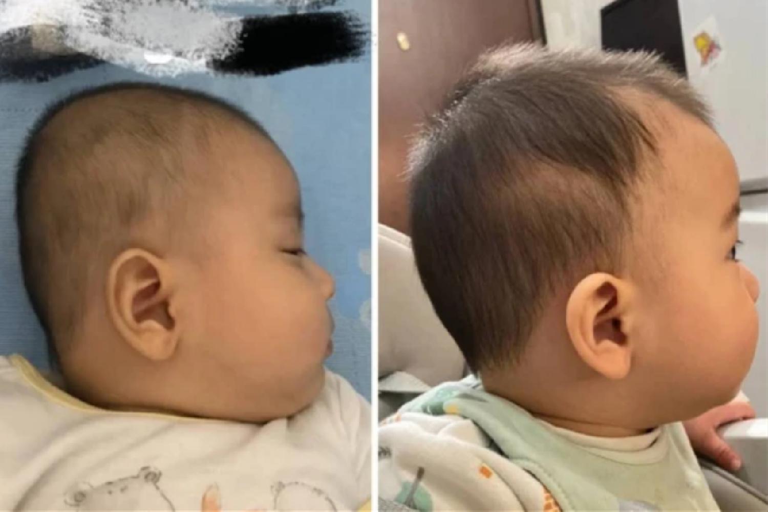 How exaggerated can "flat head" be the most flat?The girl laughs at ...