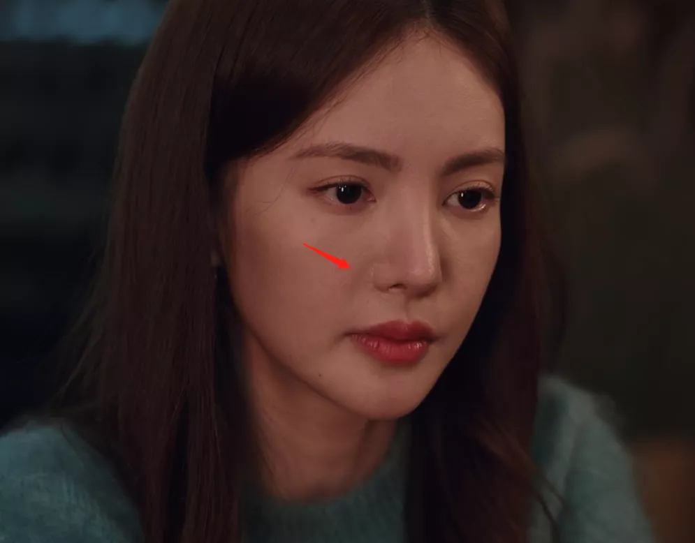 Jin Chen's nose has the same scars as Zheng Shuang, evenly distributed ...