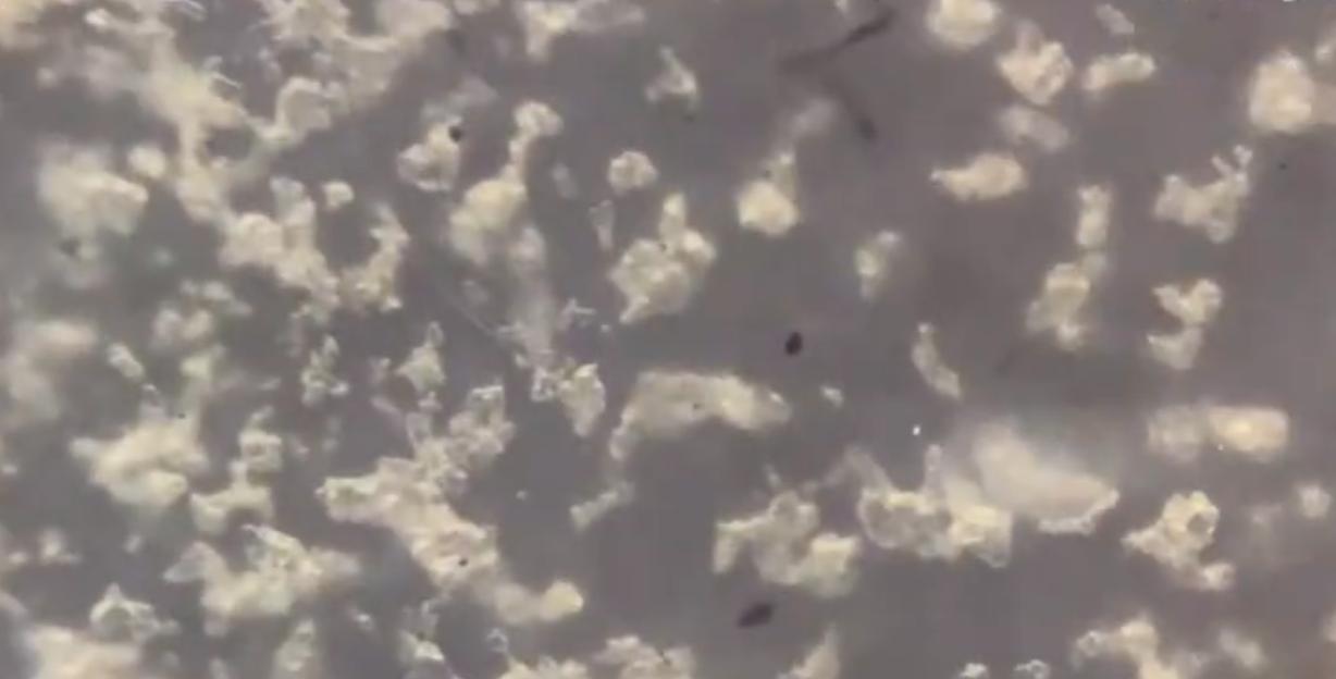 What is the "mud" in the belly button?Can you pull it?Look at the ...