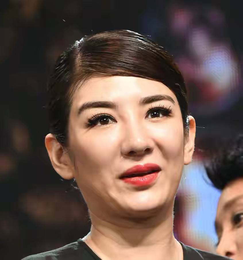 10 female celebrities ruined by plastic surgery, with snake-like faces ...