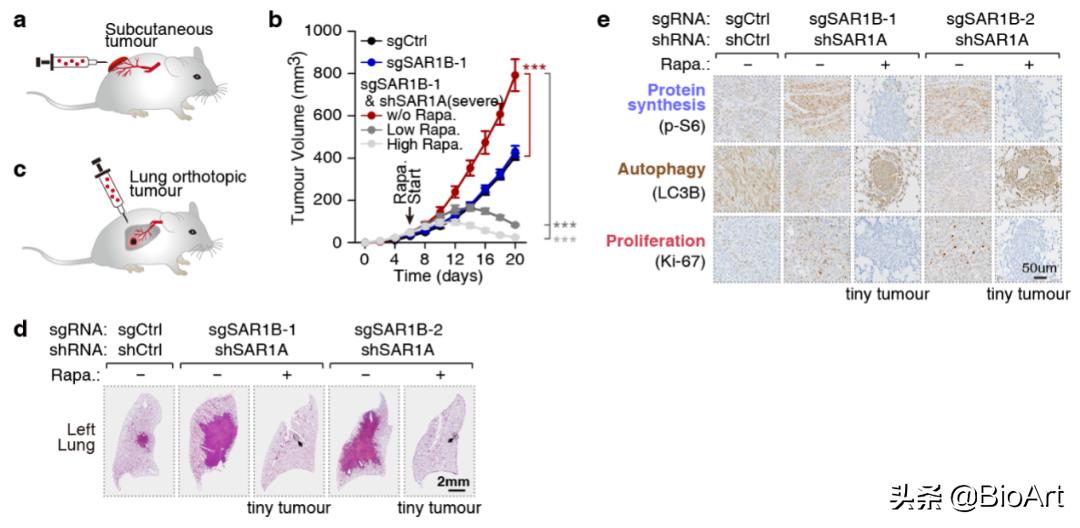 Ying Liu's group reported that SAR1B senses intracellular leucine ...