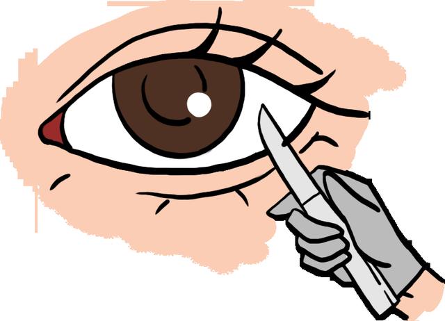 The man's eyeball is ruptured, and the artificial vitreous balloon ...