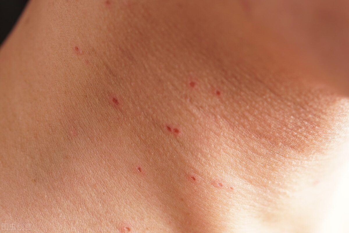 What is the little meat bump on the neck?Probably these 3 situations ...