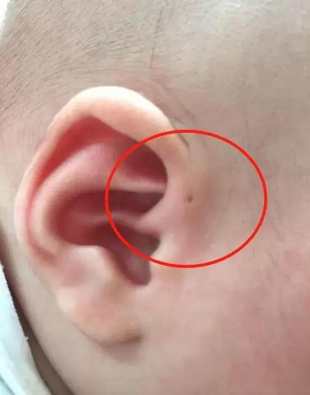 This small hole in the ear is not a symbol of "richness"!May be a ...
