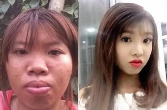 The Vietnamese girl got plastic surgery because she was too ugly, and ...