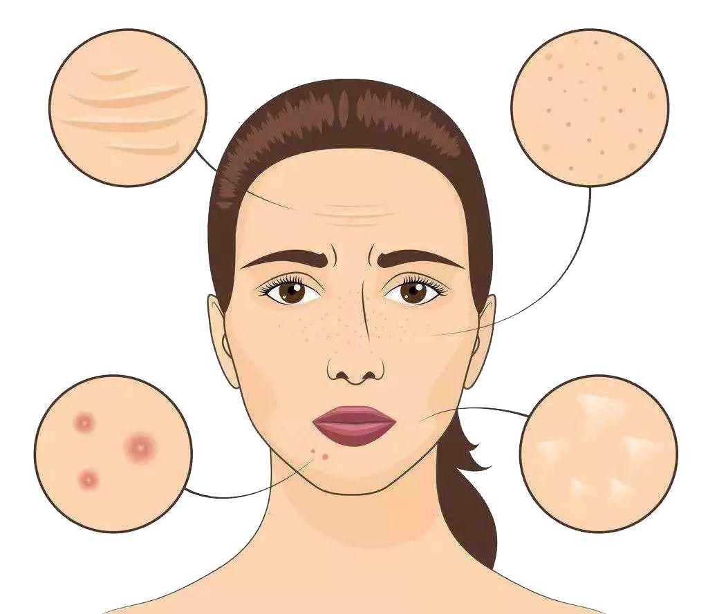 Watch out for these 4 abnormal signals from your face, which may ...