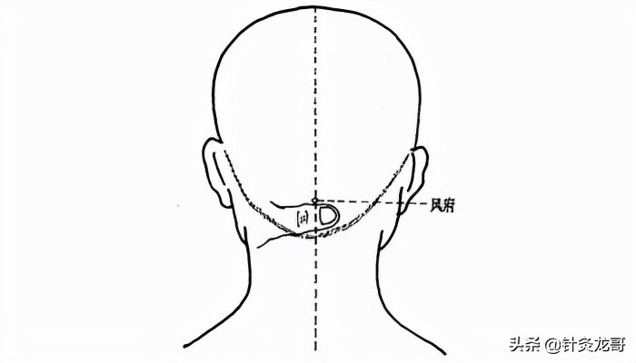 Acupuncture treatment of insomnia only Baihui, Shenmen points?Don't you ...