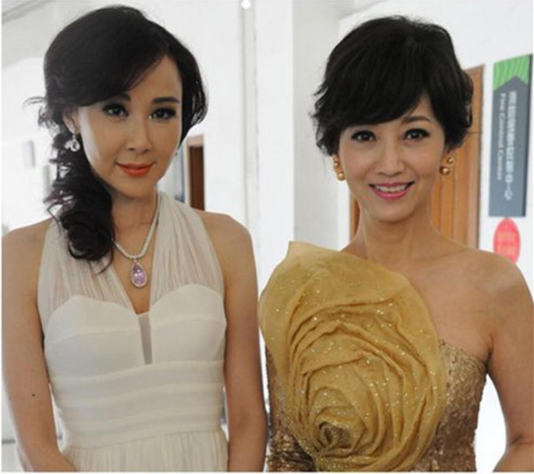 10 female celebrities ruined by plastic surgery, with snake-like faces ...