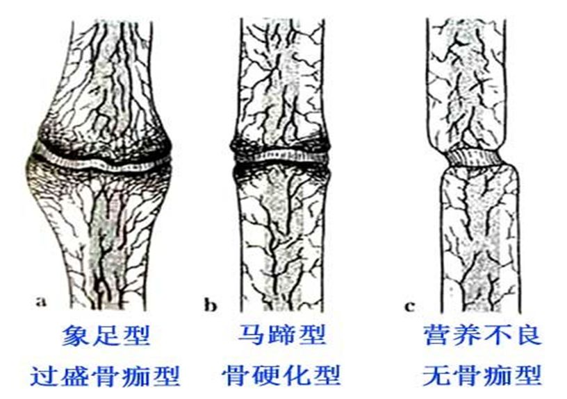 There are three types of nonunion fractures. Check your seats and see ...