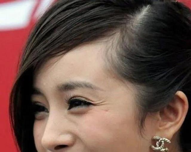 Don't be obsessed with beauty needles!These 6 female stars tell you ...