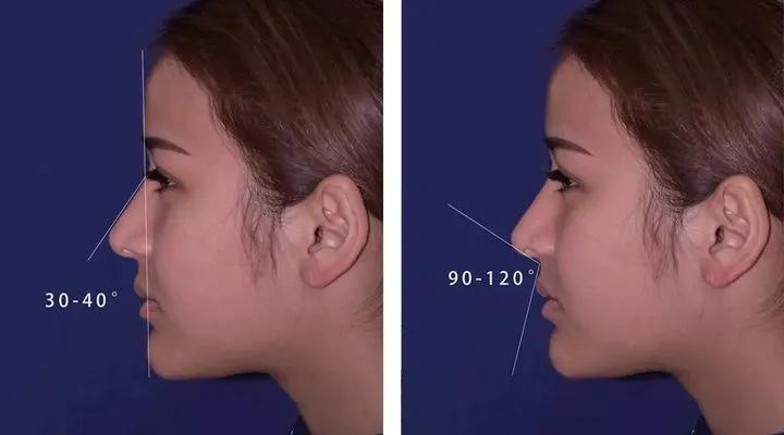 What are the elements of an ideal nose? - iNEWS