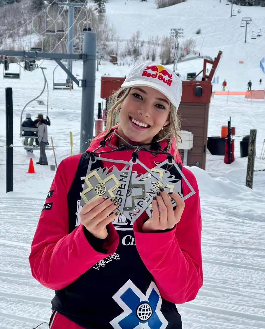 Gu Ailing announced her right hand fracture, not sure if she could ...