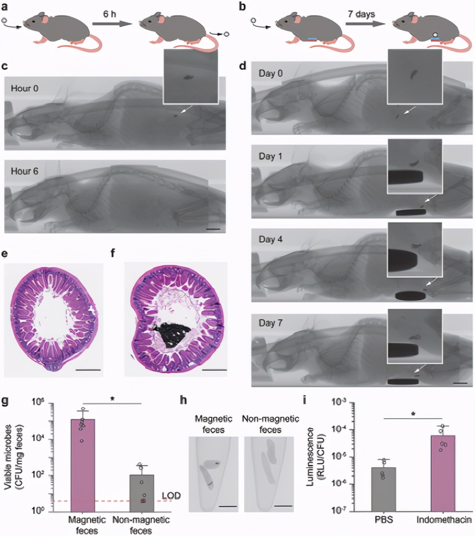 MIT Zhao Xuanhe "AFM" Magnetically active hydrogel for intestinal ...