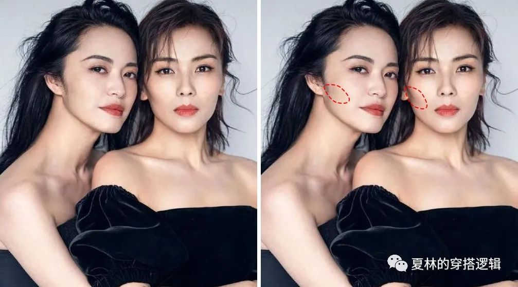 How to save sunken temples and external cheekbones - iNEWS