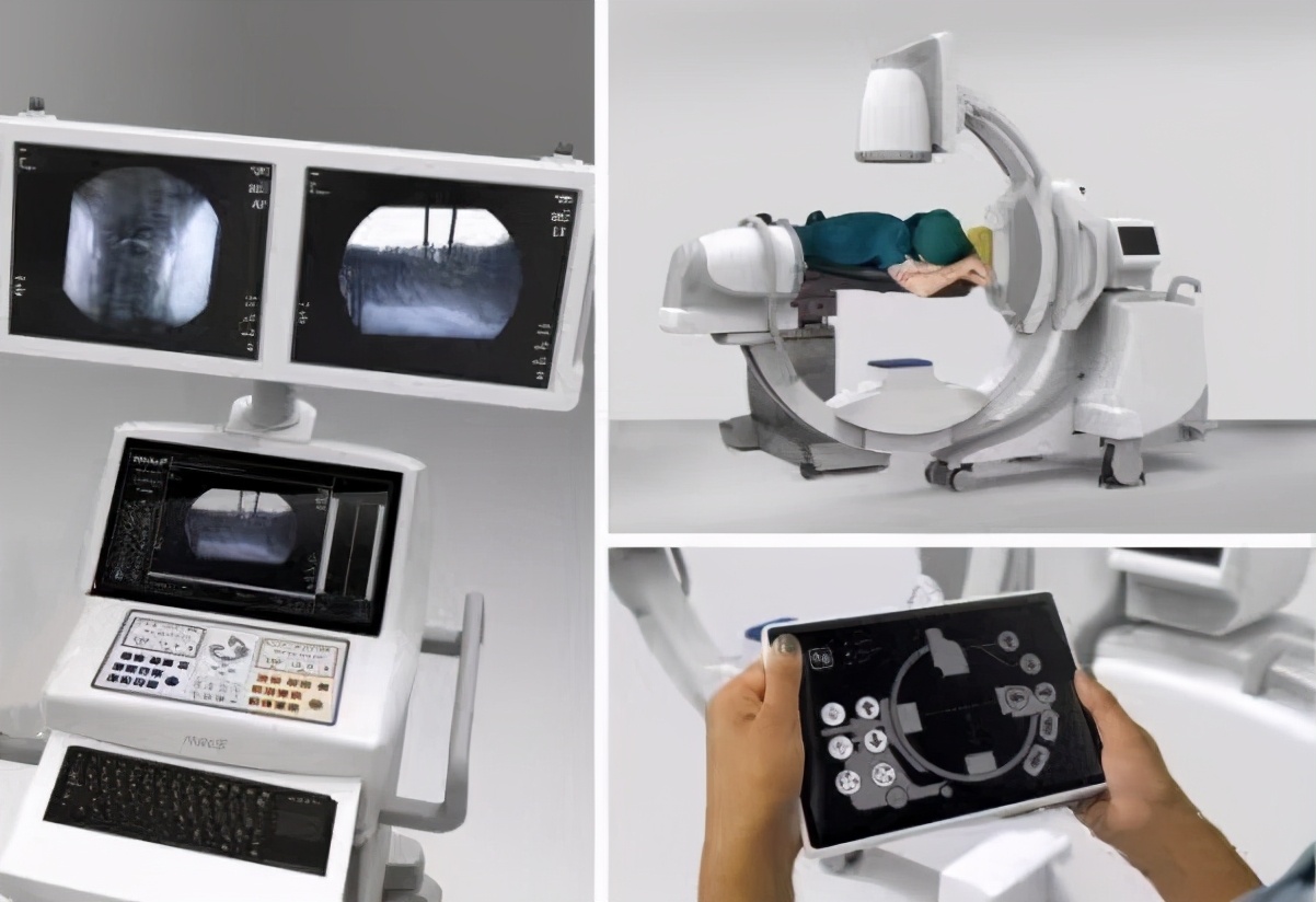 The 2.5mm incision improves the patient's pain and symptoms-Harbin ...