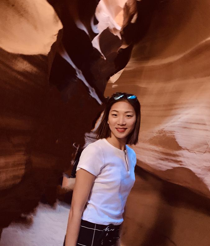 Wang Chunyu competes with a high-level face, and she looks good without ...