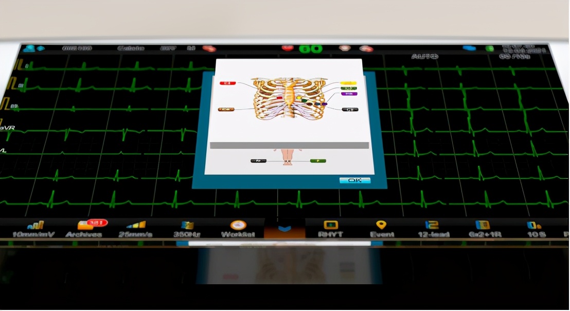 The new generation of ECG machine turned out!See how the ECG giants ...