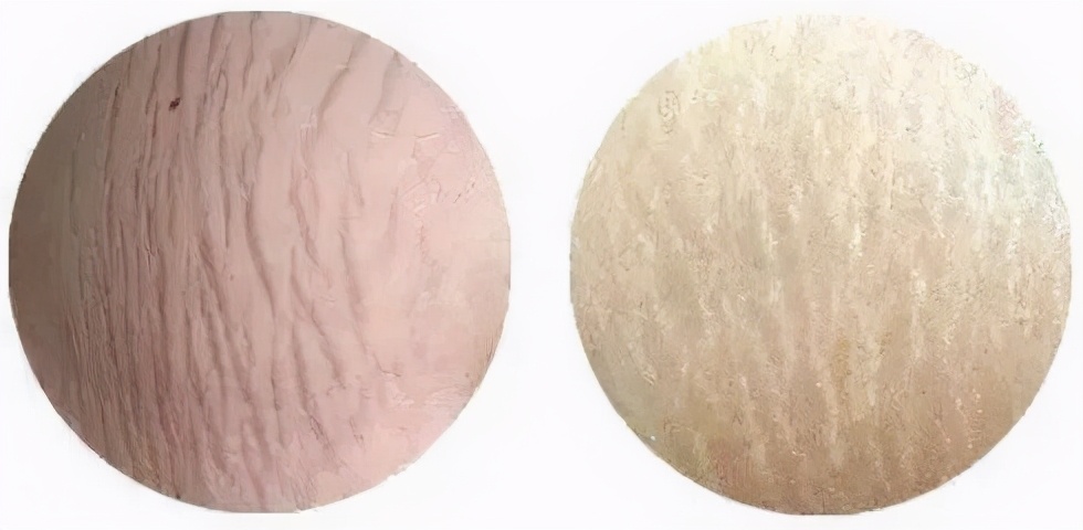 I am obviously not fat, so why do I have "fat lines"? One article to ...