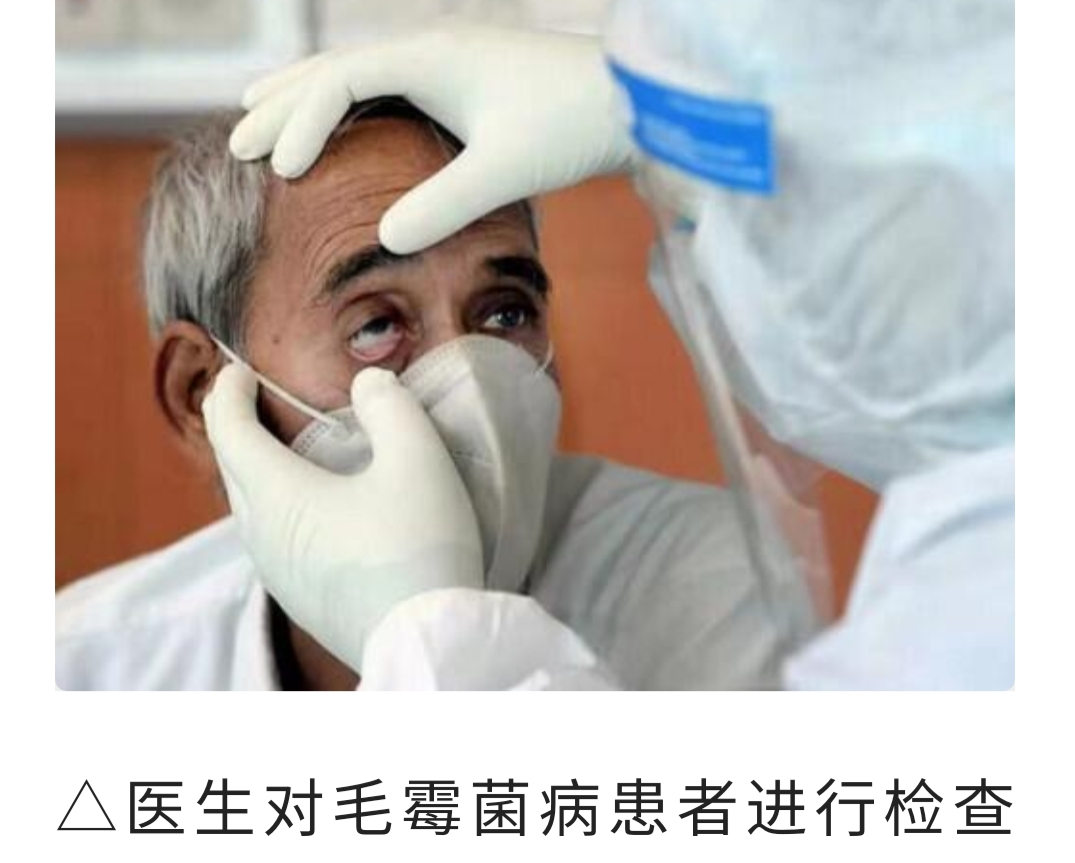 In India, the "color fungus" of "eye-digging to save lives" broke out ...