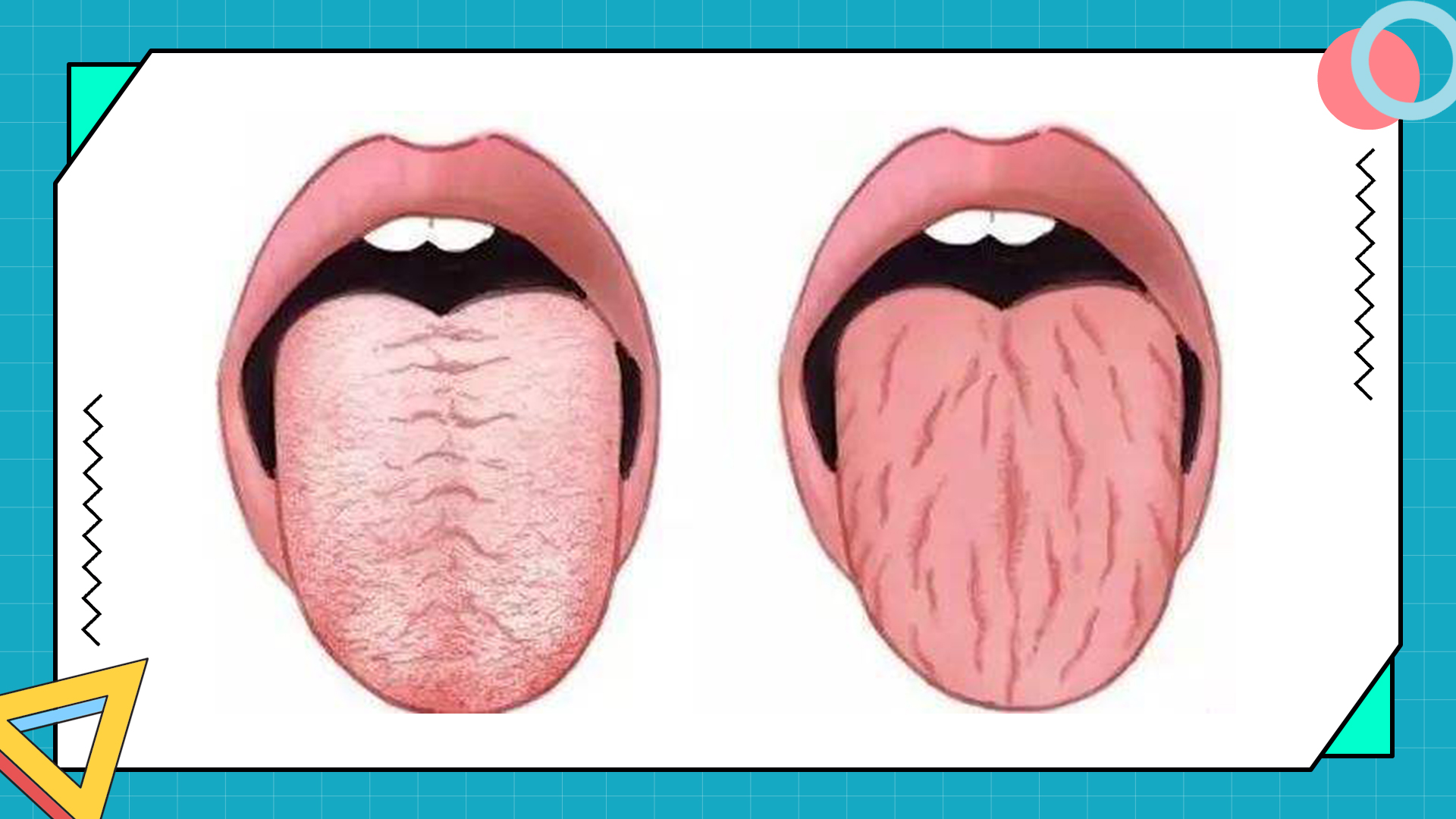There is a crack in the tongue, which is mainly caused by these 6 ...