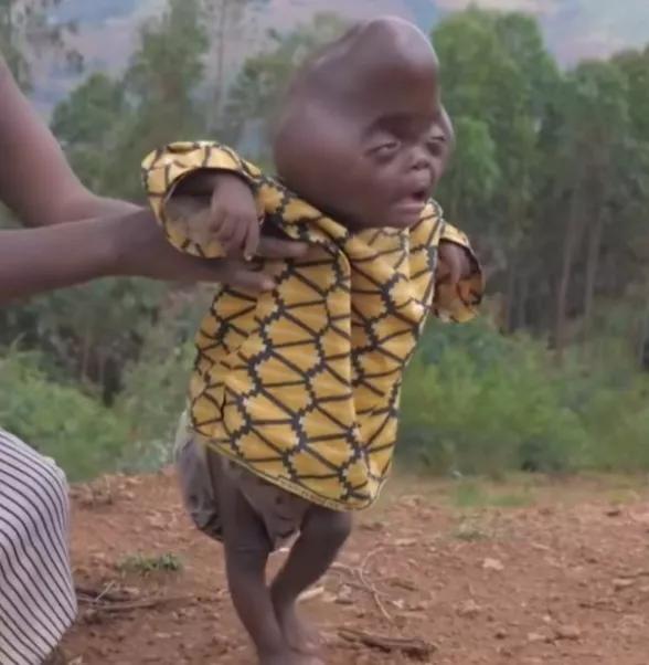 A baby born in Rwanda formed a triangle and was abandoned. The mother ...
