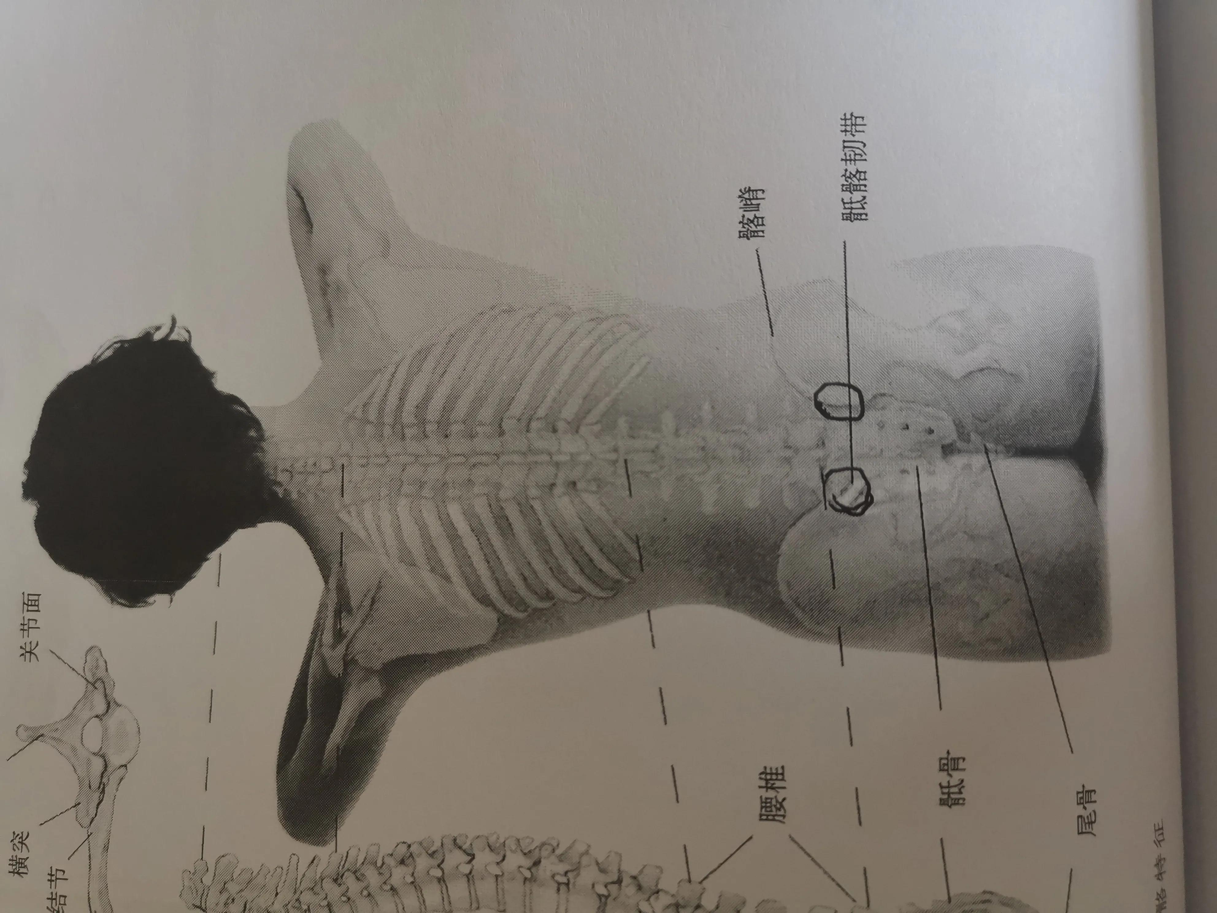 Treatment of acupuncture points on the waist with heavy lower limbs - iNEWS