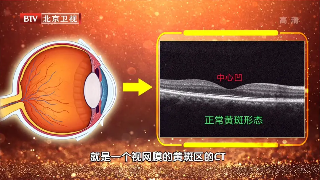 Loss of vision, blurred vision and distortion, beware of a problem with ...