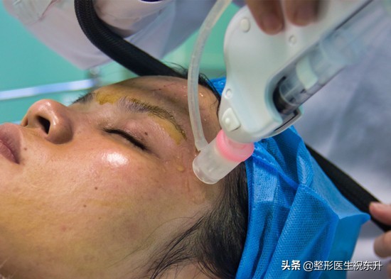 What is the effect of the "water light needle" with millions of holes ...