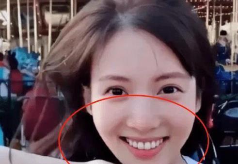 Jin Chen's face has obvious signs of cosmetic surgery, why can he still ...